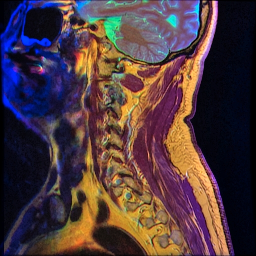 Nevit's blog: Color MRI of the Cervical verterbrae