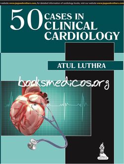 50 Cases in Clinical Cardiology 1st Edition - booksmedicos