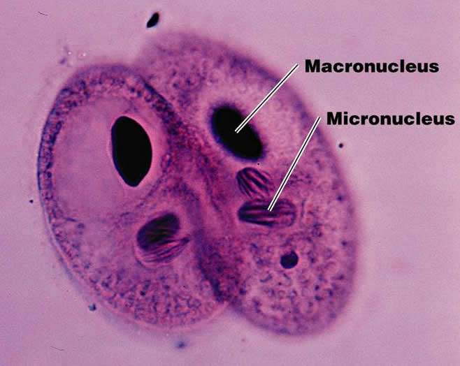 All about microbes!: Protozoa