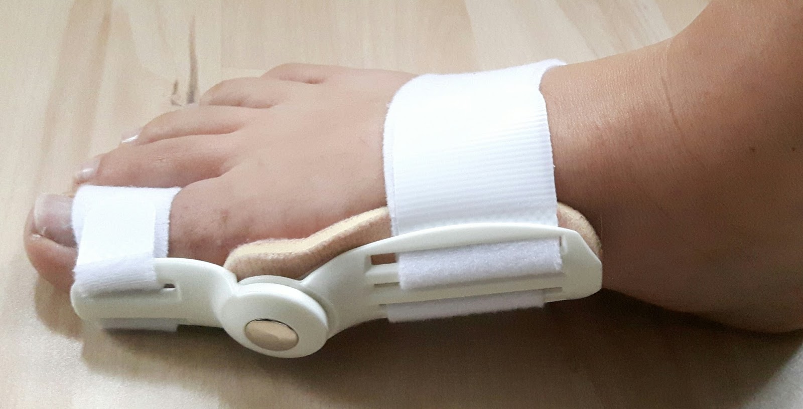 Pożegnanie z halluksami: Praktyczne porady przed operacją haluksa