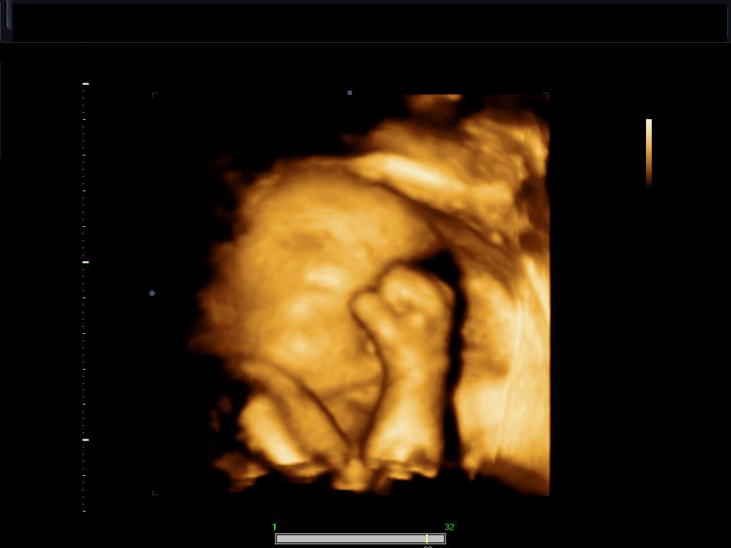 Baby 3D 4D Scan: Baby 3D 4D Scan