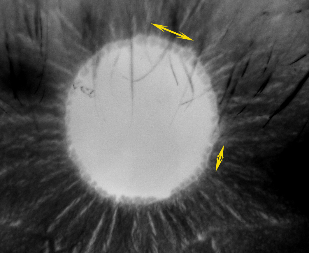 Modern & Multidimensional Iridology: Important Iris Signs at IPB, Pupil ...