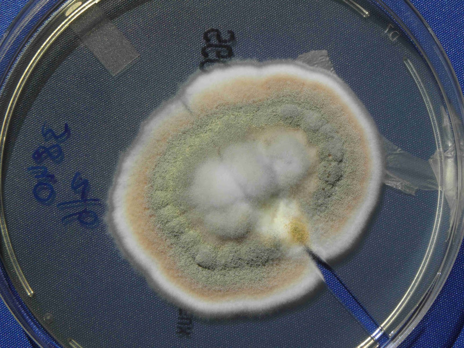 ATLAS MICOLOGIA: ASPERGILLUS VERSICOLOR