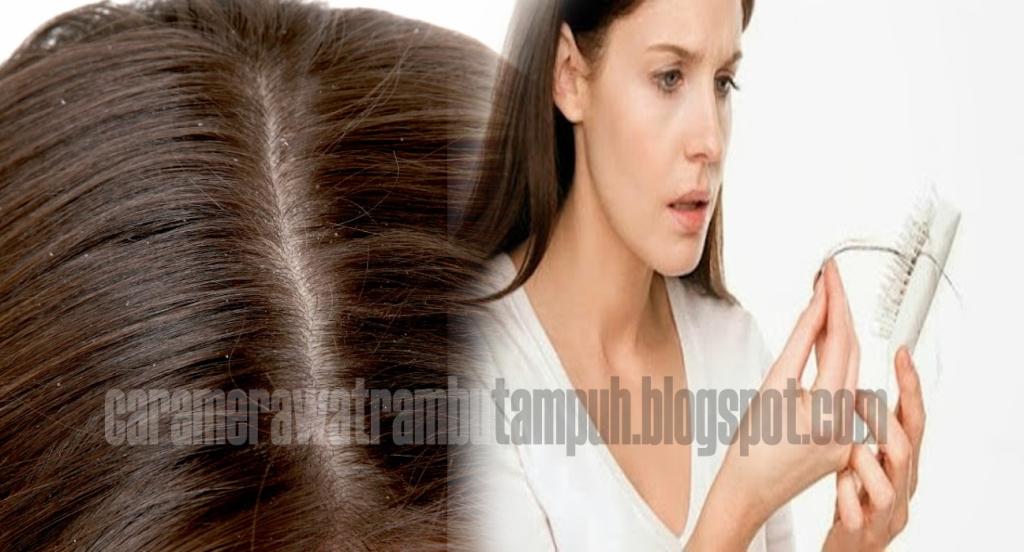 Cara Merawat Rambut Rontok dan Berketombe | Cara Merawat Rambut Ampuh