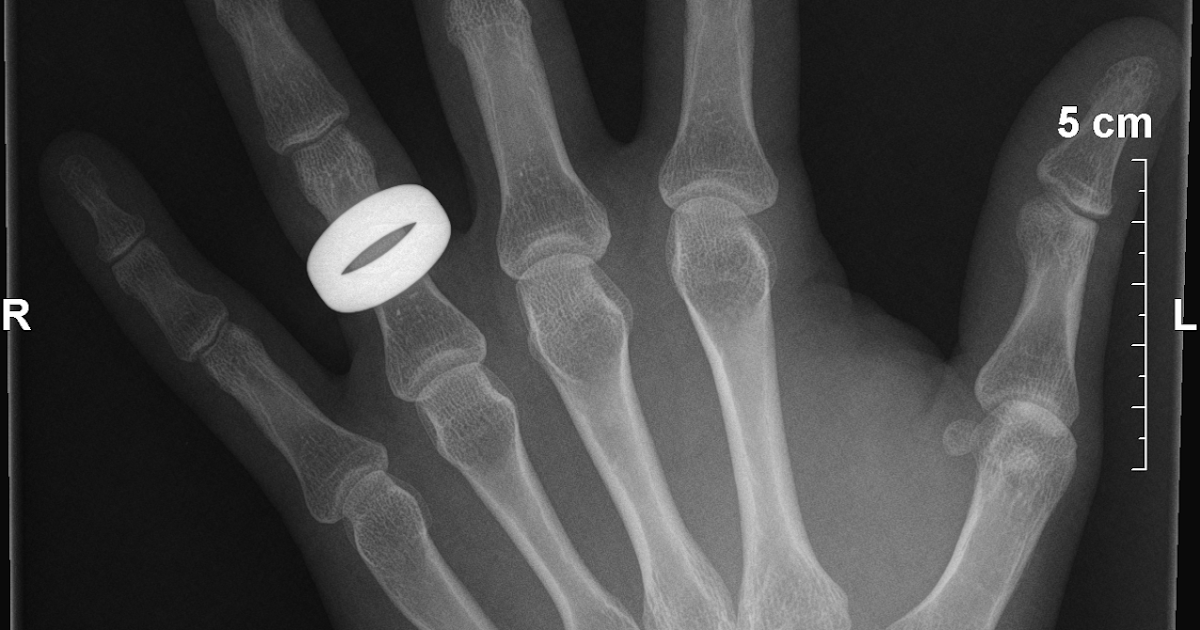 Faktoider: Tolvan Tolvansson