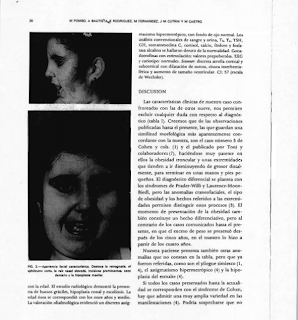 CMC : Síndrome de cohen.