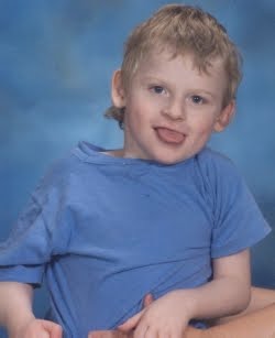 conociendo los sindromes: SINDROME ANGELMAN