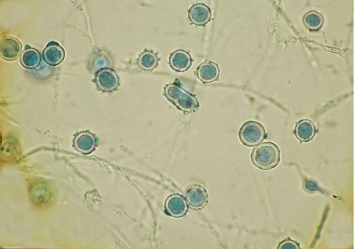 ATLAS MICOLOGIA: CONIDIOBOLUS CORONATUS