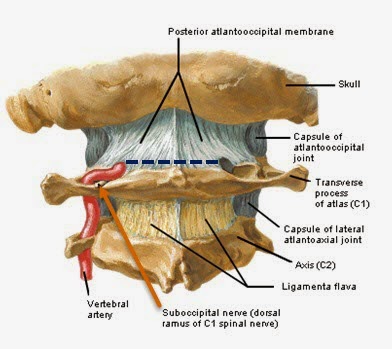 ...but maybe tomorrow: C1 Nerve Root Block