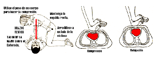 CURSO HERRAMIENTAS WEB 2.0: Importancia de realizar la Reanimación ...