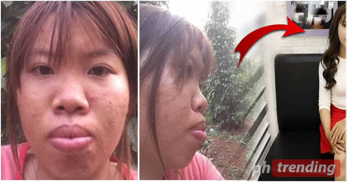 This Woman Grew Up Insulted for Being ‘Ugly’, Finally Gets Her Happily ...