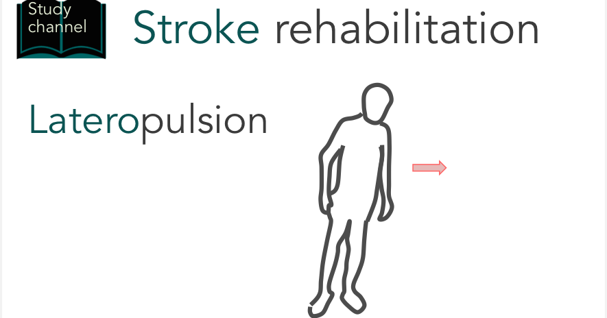 Lateropulsionの特徴とリハビリテーション - Study channel