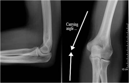 ardi aja: elbow joint