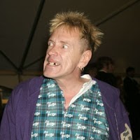 Glam-Racket: The Baker's Dozen Rock Stars With Bad Teeth