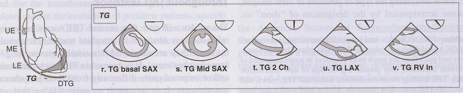 Pedi cardiology: TEE - Basic Views & terminology