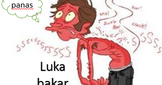 Asuhan Keperawatan Pada Tn. P Dengan Luka Bakar (combustio)