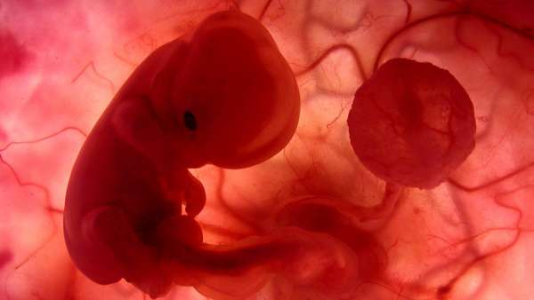 FETOS AFECTADOS POR LA CONTAMINACIÓN