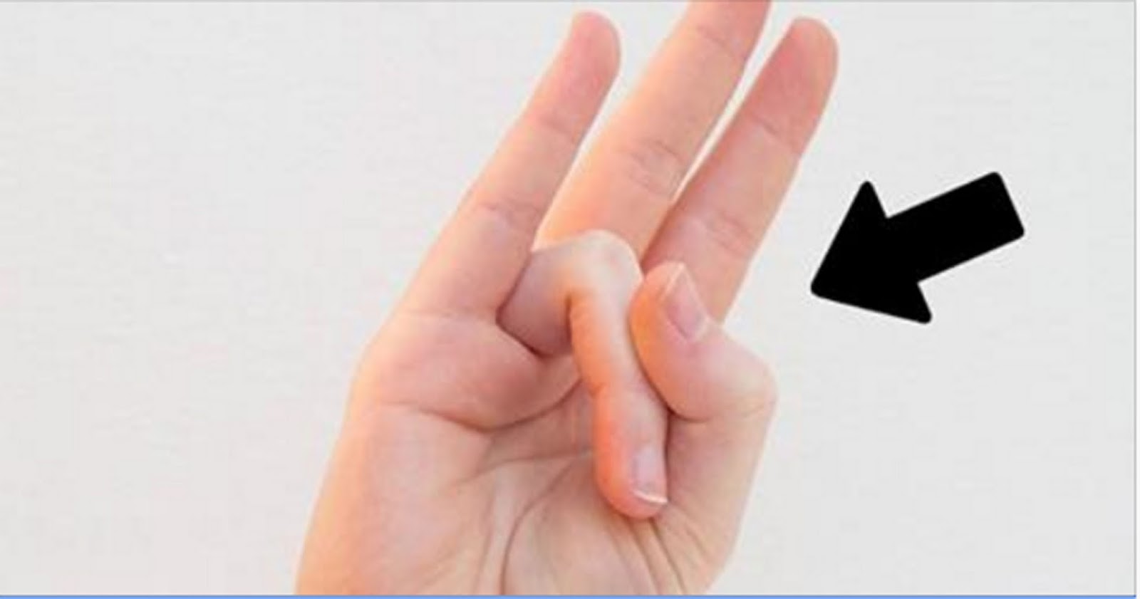 Stretch Your Ring Finger With Your Thumbs And Maintain For A Few