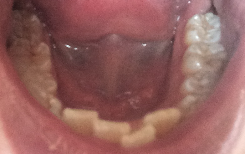 Oi Brace Face!: Mush and Slush