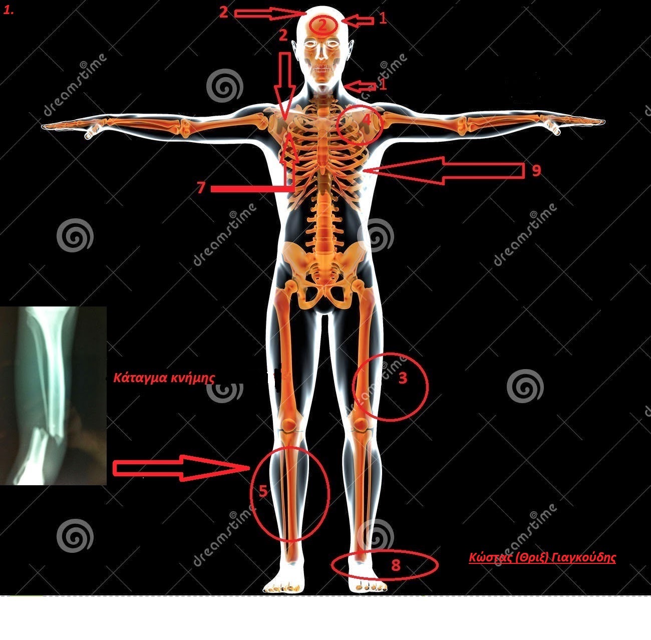 ΟΡΦΙΚΗ ΚΑΙ ΠΛΑΤΩΝΙΚΗ ΘΕΟΛΟΓΙΑ: Ο ΤΑΦΟΣ ΤΗΣ ΑΜΦΙΠΟΛΗΣ-ΟΙ ΤΡΑΥΜΑΤΙΣΜΟΙ ...
