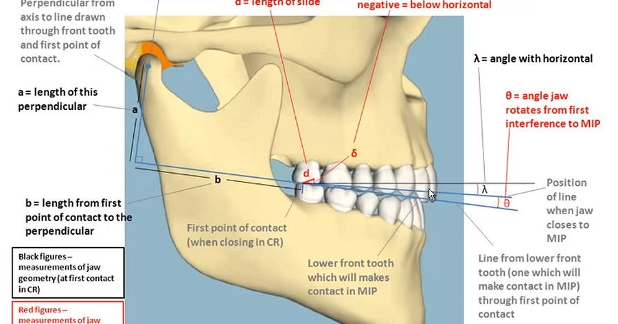OCCLUSION: Condylar Axis Movement from Centric Relation to MIP - Odonto-Tv