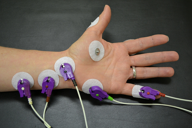 Final Year Project - Development of EMG Circuit for Controlling an ...