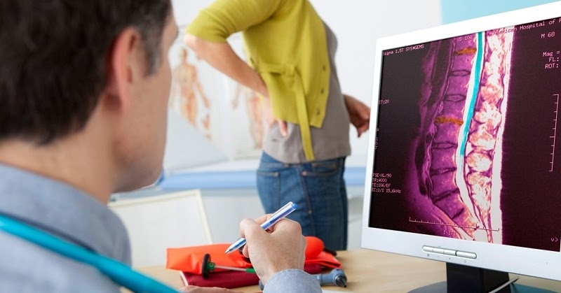 Understanding Sciatica: Causes and Symptom Overview