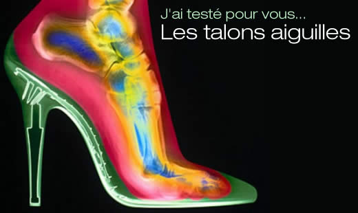 Blog 75: Billets-Talons aiguilles