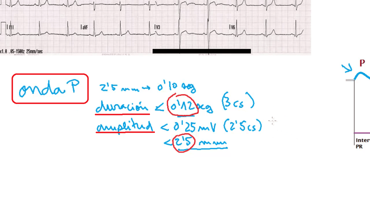 ECG normal (12): Onda P (duración, voltaje y morfología) | Dr. Alberto ...