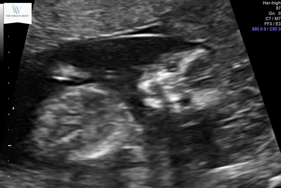 Misadventures of the Dynamic Uno