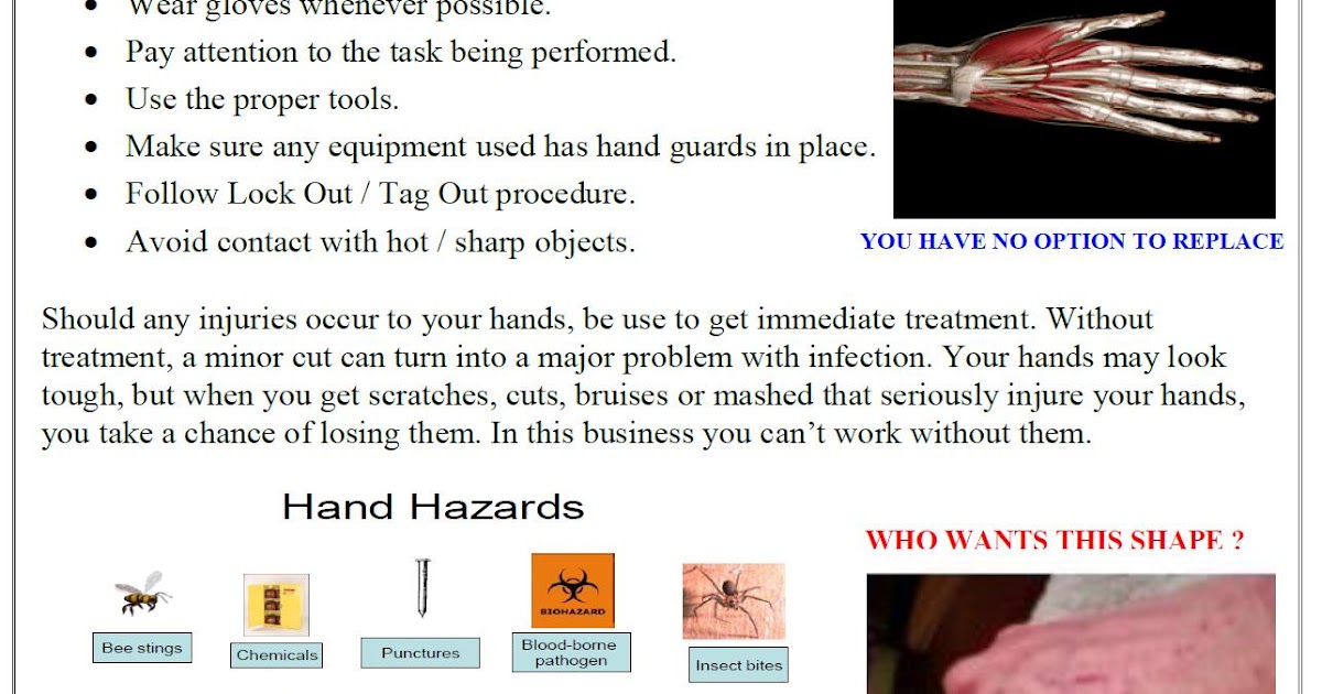 HSE Tech Solutions: Hand Protection