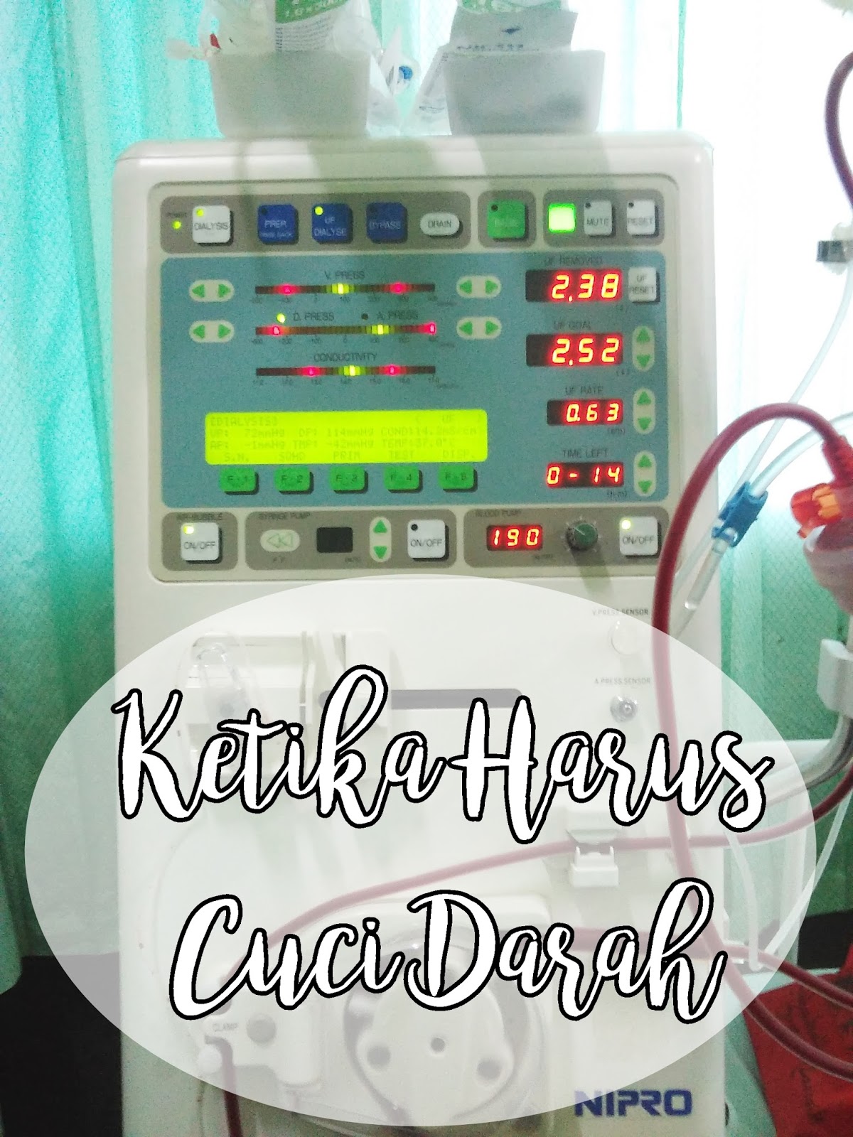 Ketika Harus Cuci Darah (Hemodialisa) - Cerita Cha Tentang Hal Biasa