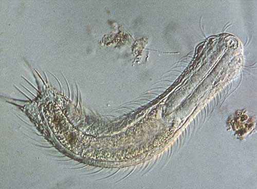 PHYLUM GASTROTRICHA