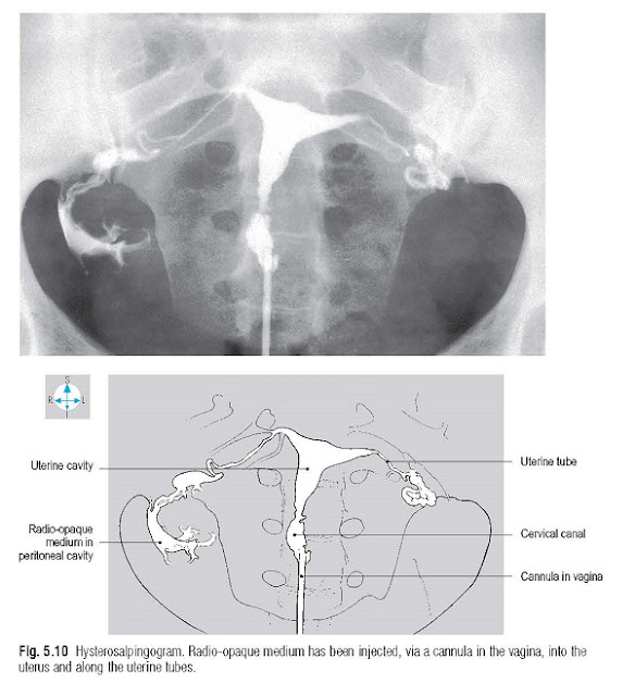 Female Internal Reproductive Organs Anatomy and Physiology - pediagenosis