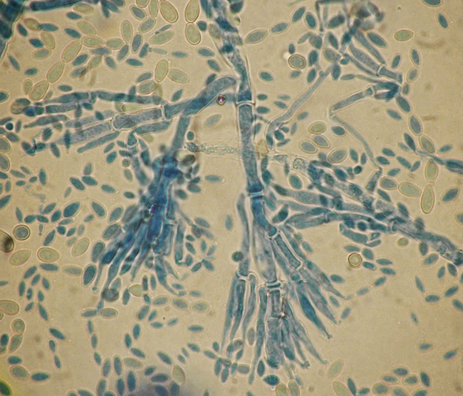 ATLAS MICOLOGIA: PAECILOMYCES VARIOTII
