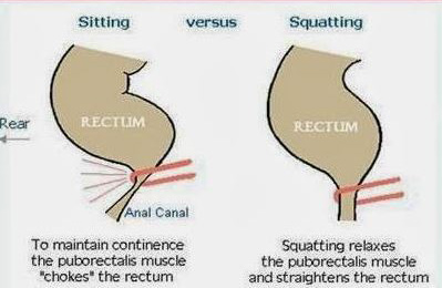 Kenapa Buang Air Besar Mencangkung Lebih Baik? | RINGKAS TAPI SEDAP