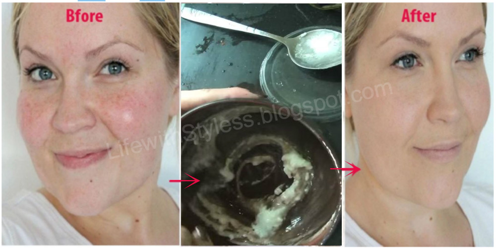 I LOVE THIS CHOCOLATE MASK SO MUCH. AFTER FIRST USE, MY SKIN FEELS SO ...