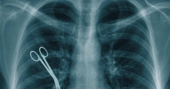 The Medical Journal: Shocking surgical items that have been left inside ...