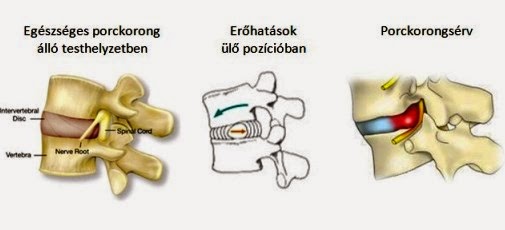 Rea Jógabirodalma: Gerinc Percek: A gerinc felépítése és a gerincsérv