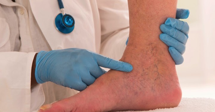 EmergenMed Health Blog: Recomendaciones actuales en diagnóstico y ...