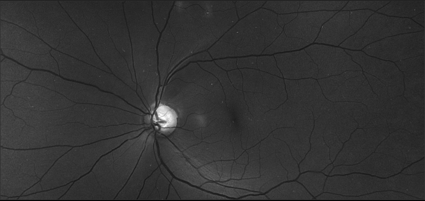 Sonoran Desert Eye Center: 2018