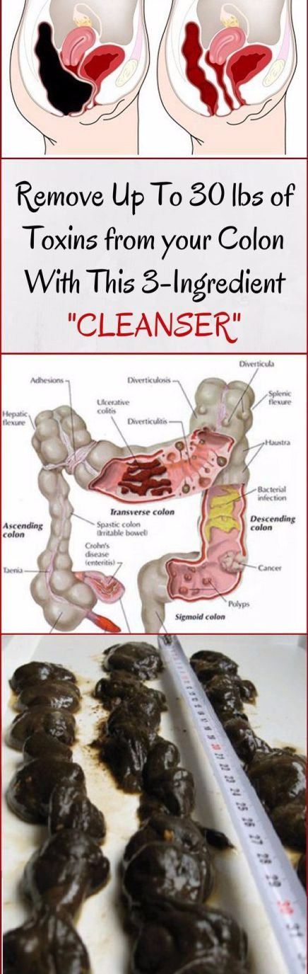 HOW TO REMOVE 20 POUNDS OF TOXIC FAT FROM YOUR COLON | HEALTHYTIPS