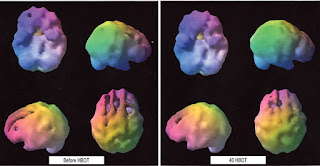 The Arts, Sciences and Medicine: QUANTIFICATION OF UNCERTAINTY
