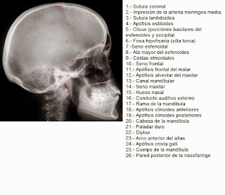 E-Anatomía Odontológica: grupo 1 rx lateral nueva