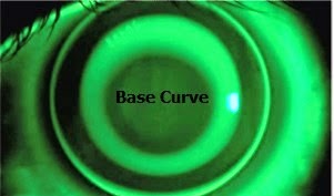 Troubleshooting Your Orthokeratology Fit - Eyedolatry