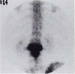 MedFriendly Medical Blog: The Mickey Mouse Sign in Medicine: Part 1