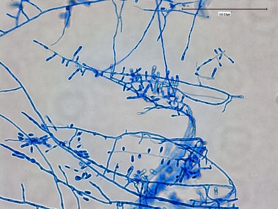 Fun With Microbiology (What's Buggin' You?): Trichophyton terrestre