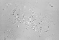 Enfermedades de Transmisión Sexual: Candidiasis: ¿Que es?, Tipos