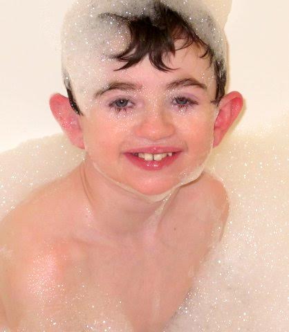 Into the Unknown We Go : Get to know some other Cohen Syndrome families ...