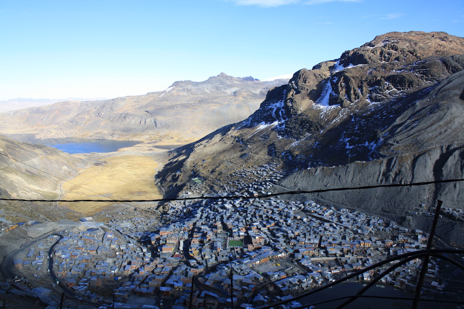 La Rinconada: Medical Care for Miners at the Top of the World ~ Project ...